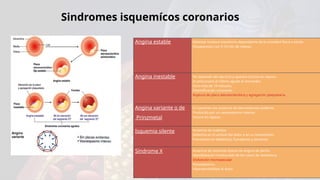 2) Cardiopatía Isquémica- Carlos Fuentes Jiménez.pptx
