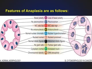 characteristic features of tumours | PPTX
