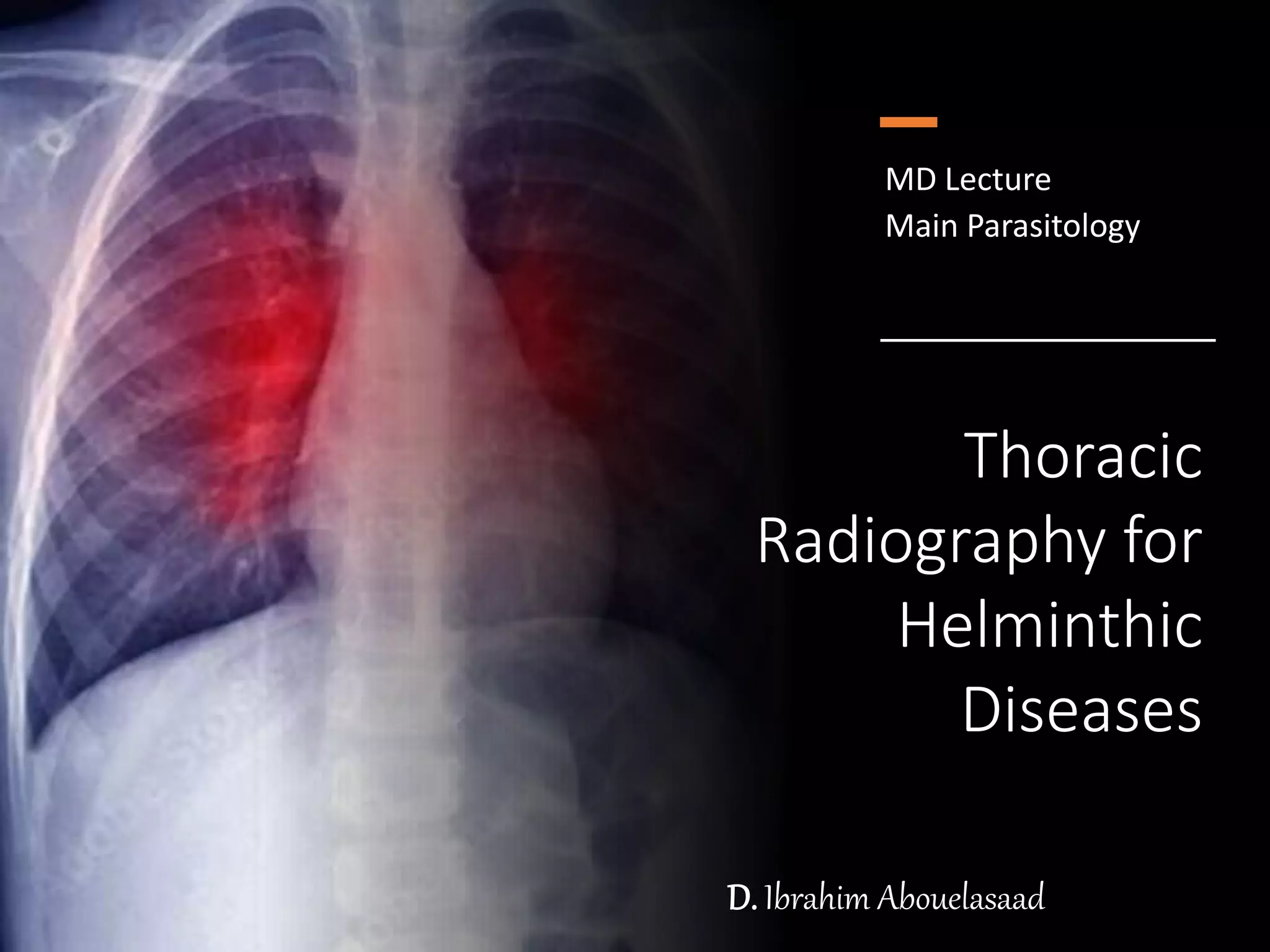 2) chest soft tisue Radiological for helminth infections.pptx