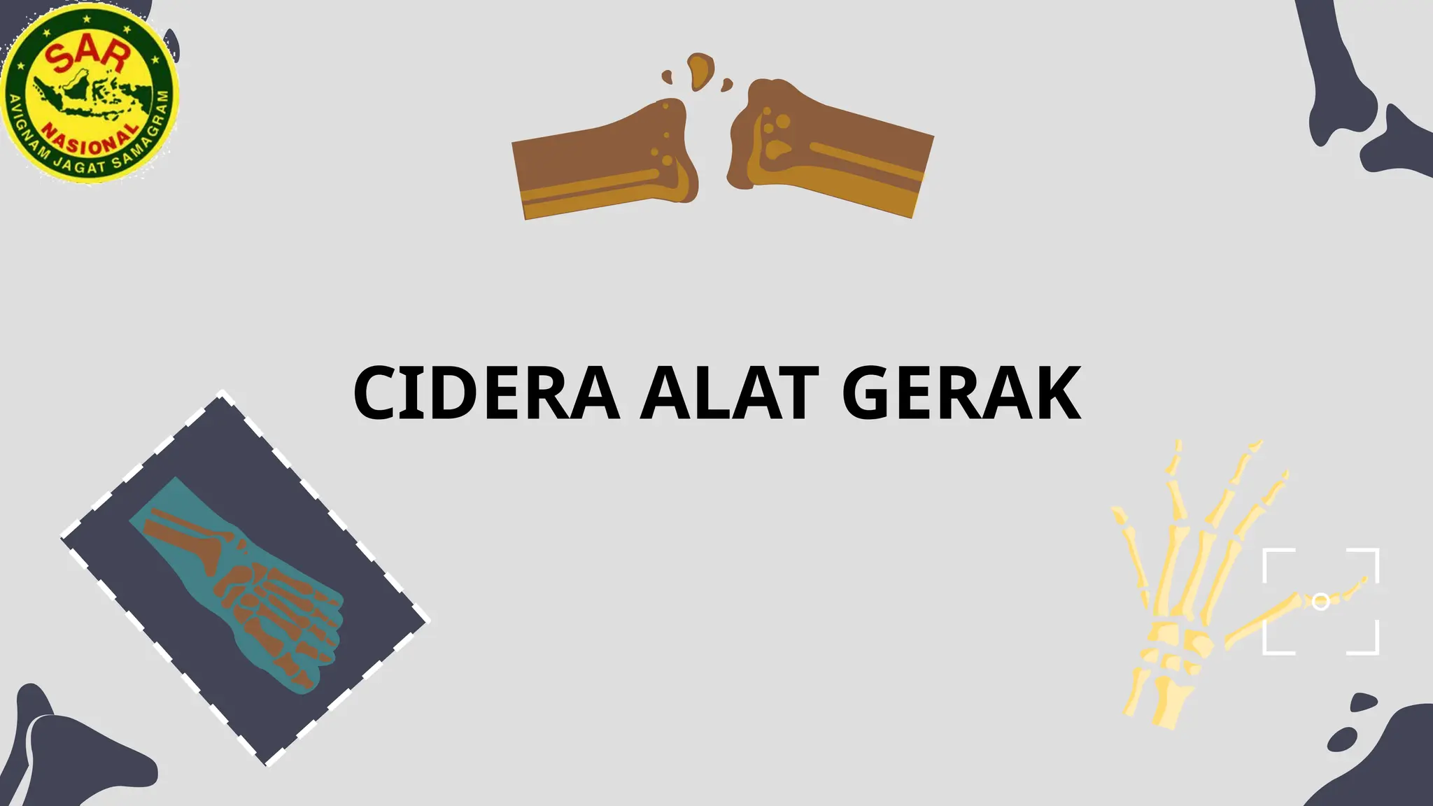 CEDERA MUSKULOSKELETAL ATAU CEDERA ALAT GERAK | PPTX