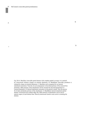 2 clasp retained partial denture | DOC