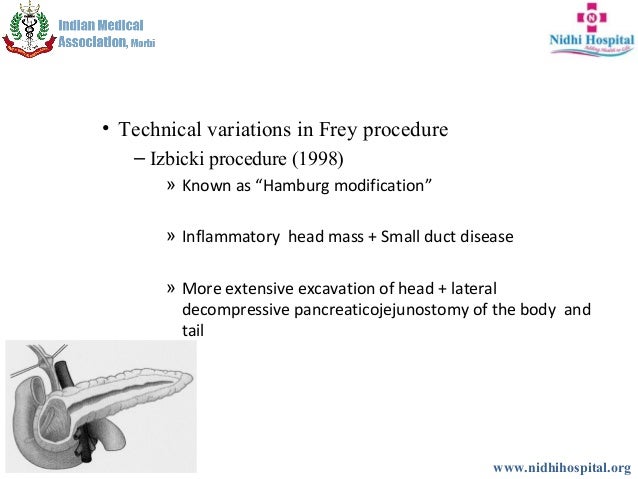 Surgical Management of Chronic Pancreatitis
