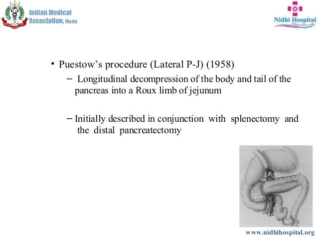 Surgical Management of Chronic Pancreatitis