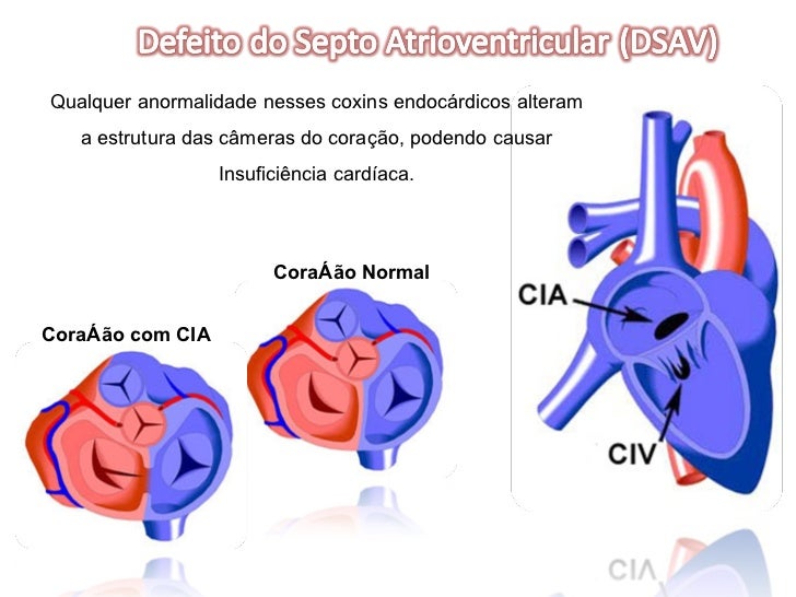 Cardiopatias Congênitas