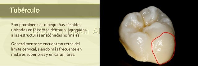 Anatomía dental y oclusión / 1er unidad / 2da clase: Elementos arquit…