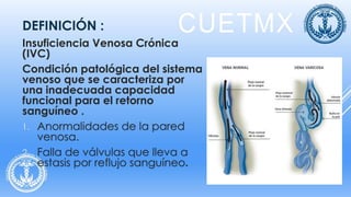 2da CLASE - Enfermedad Venosa - CLASIFICACIÓN CEAP - CUETMX.pdf