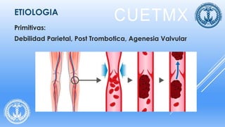 2da CLASE - Enfermedad Venosa - CLASIFICACIÓN CEAP - CUETMX.pdf