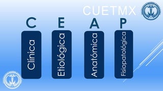 2da CLASE - Enfermedad Venosa - CLASIFICACIÓN CEAP - CUETMX.pdf