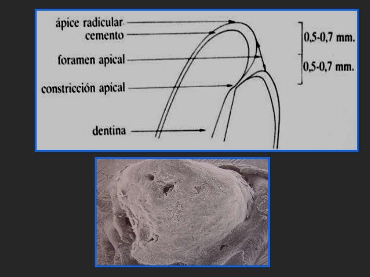 anatomia apice radicular