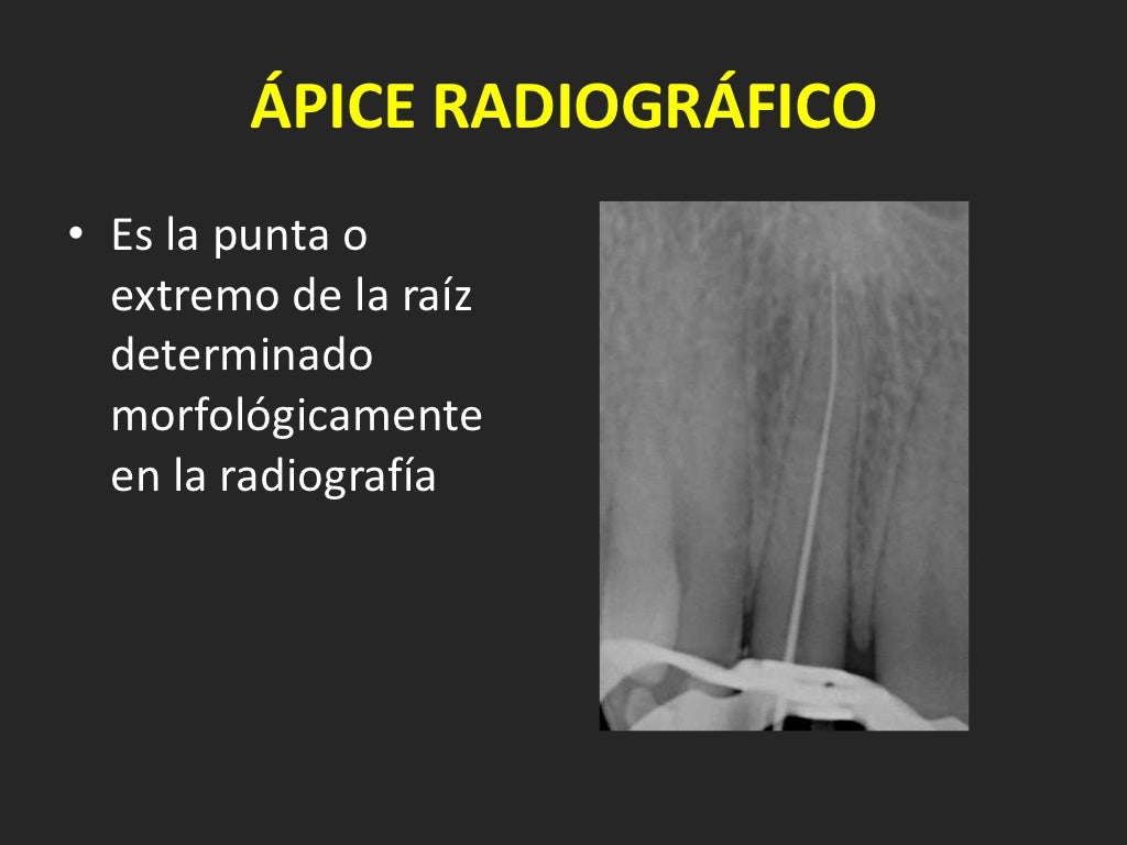 anatomia apice radicular