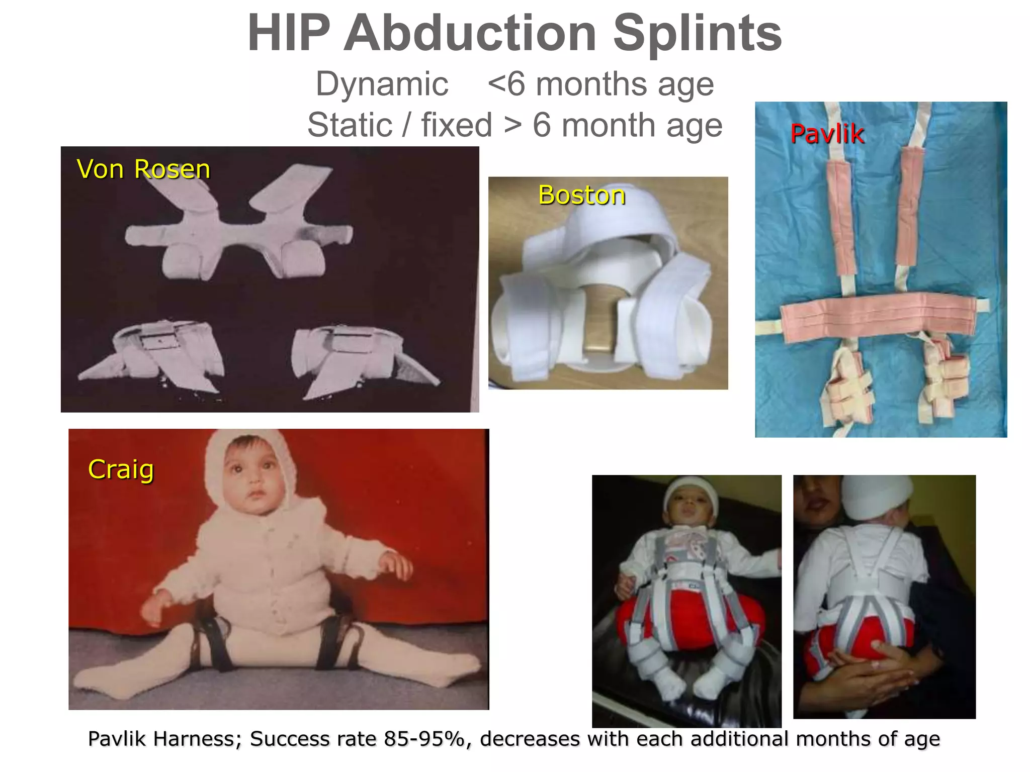 2 ddh principles & protocols of rx. 0 12 m age | PPT