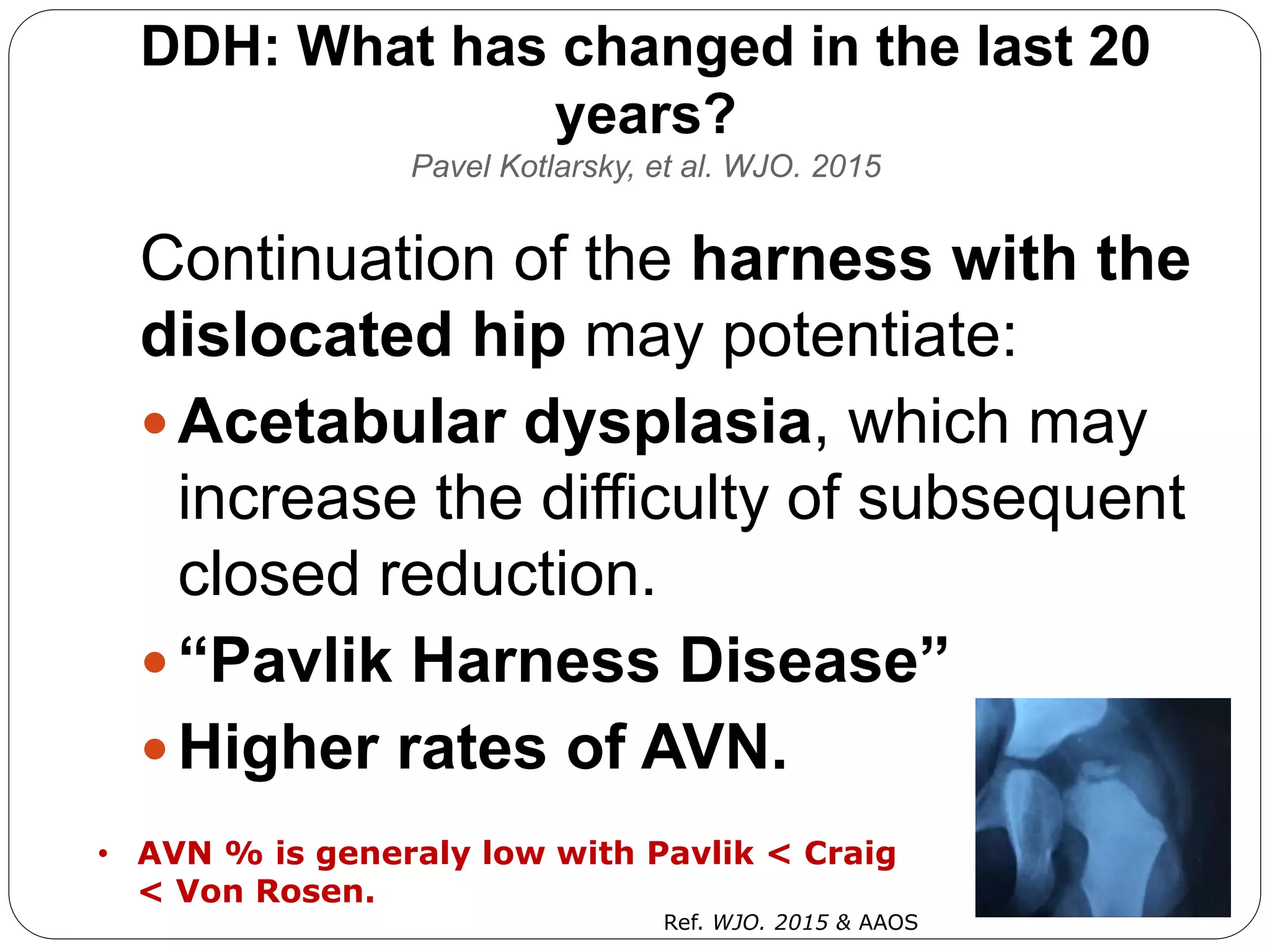 2 ddh principles & protocols of rx. 0 12 m age | PPT