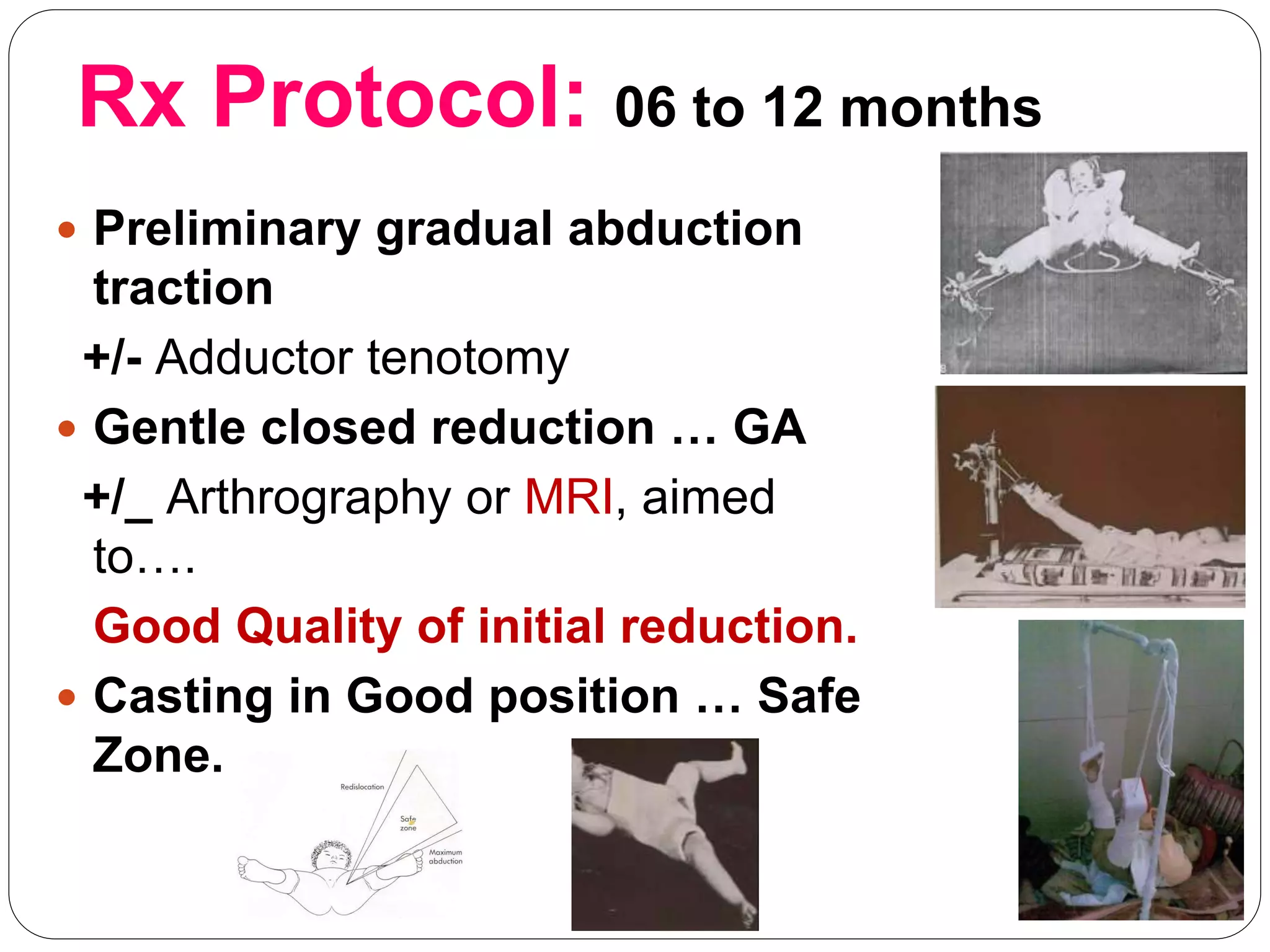 2 ddh principles & protocols of rx. 0 12 m age | PPT