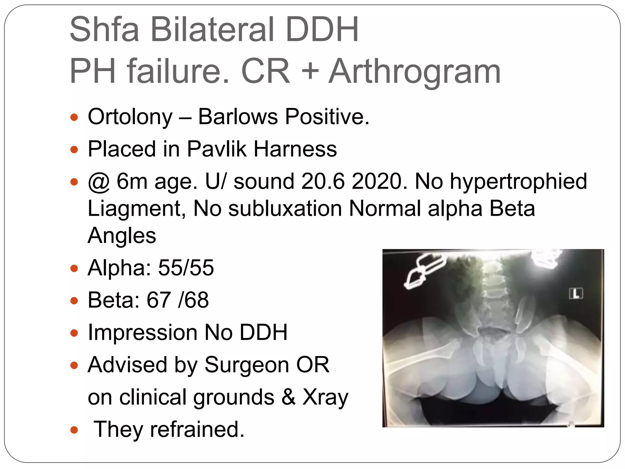 2 ddh principles & protocols of rx. 0 12 m age | PPT