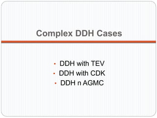 2 ddh principles & protocols of rx. 0 12 m age | PPT