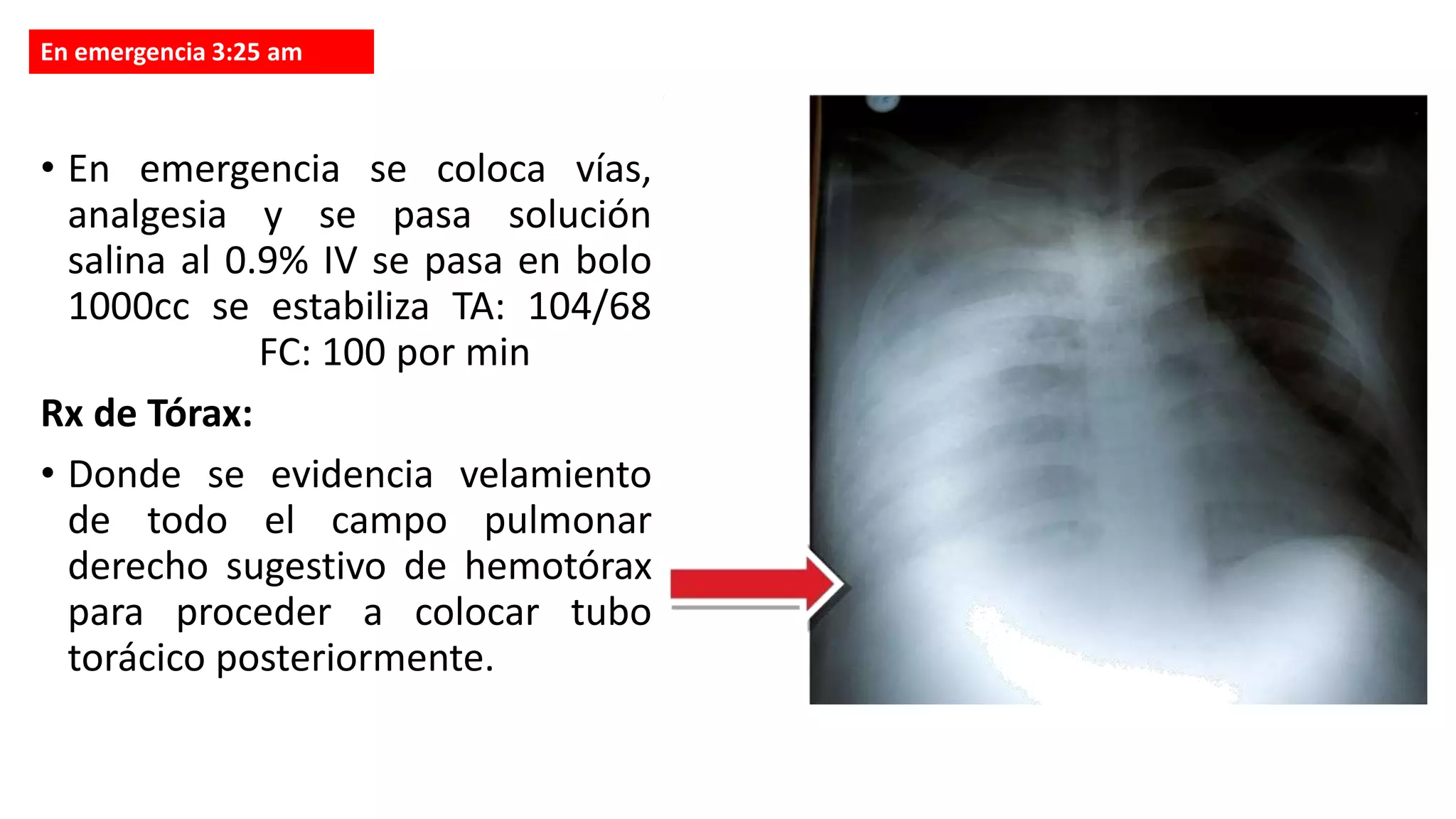 2 de 5_Trauma toracico abierto.pptx