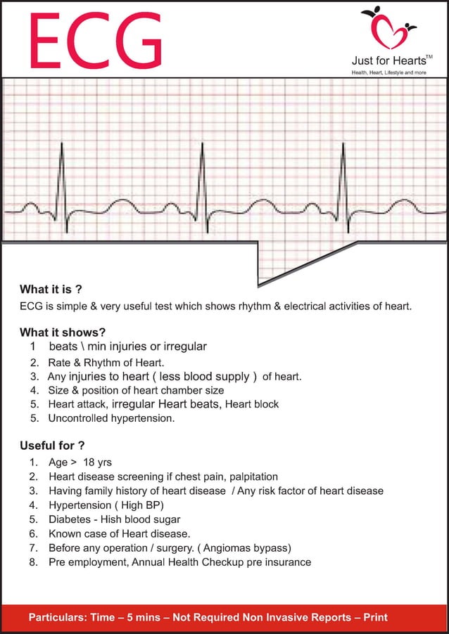ECG - Electrocardiogram | PDF