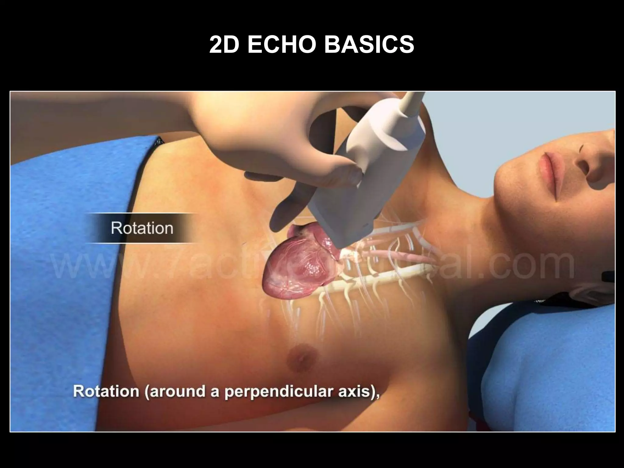 2d Echo Basics | PPTX