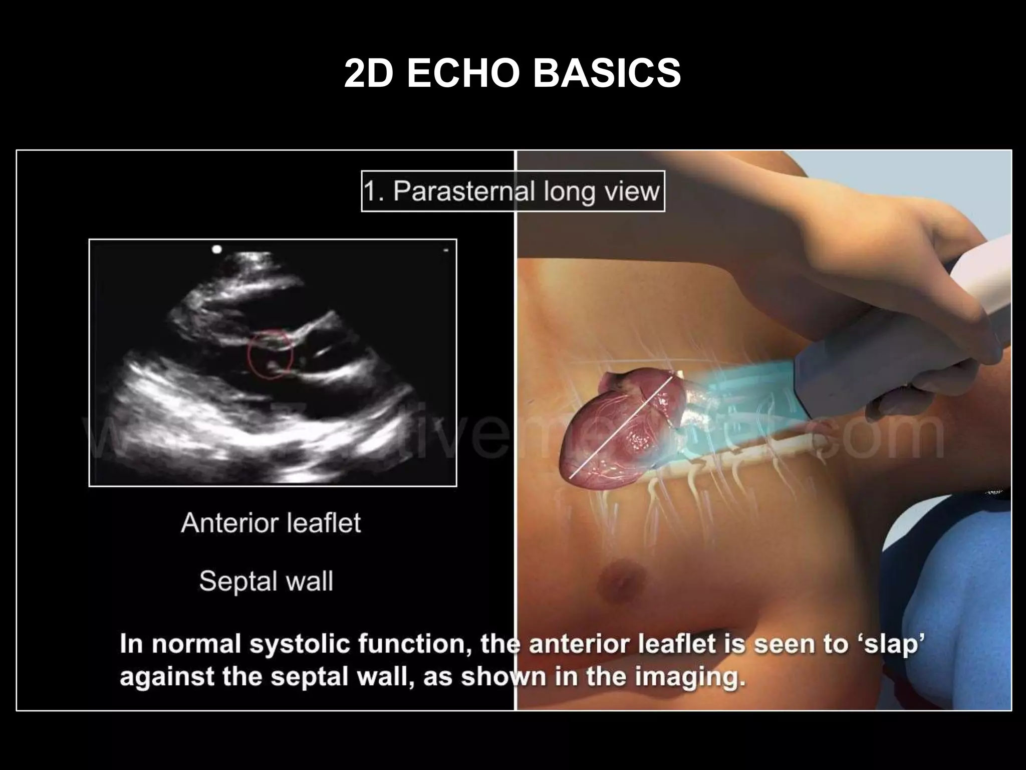 2d Echo Basics | PPTX