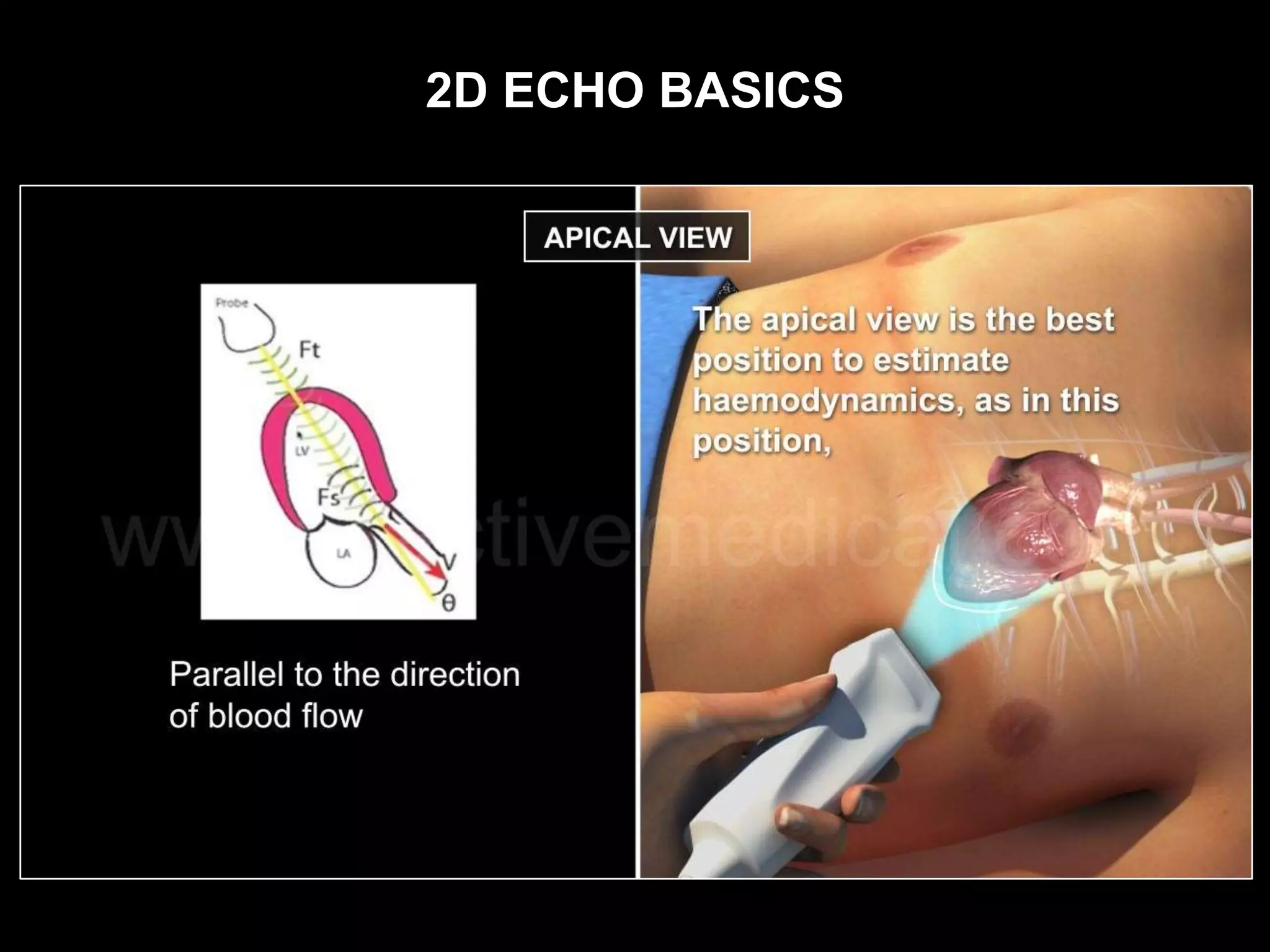 2d Echo Basics | PPTX