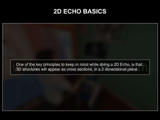 2d Echo Basics | PPTX