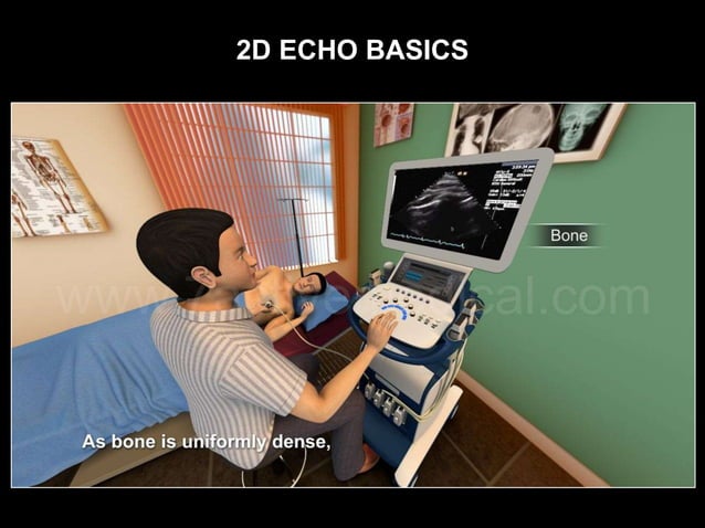 2d Echo Basics | PPTX | Technology & Computing