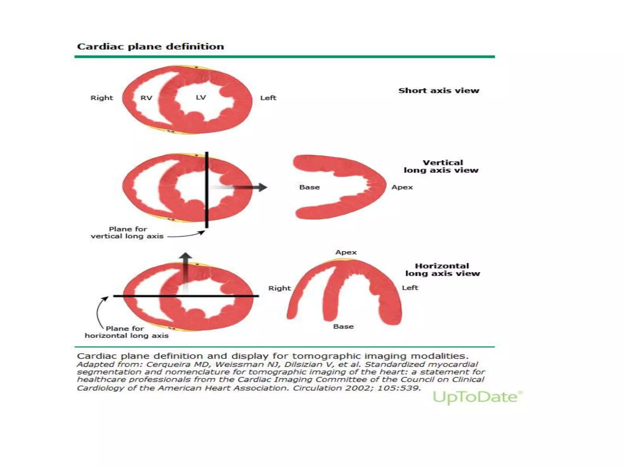 2 d echocardiography views | PPTX
