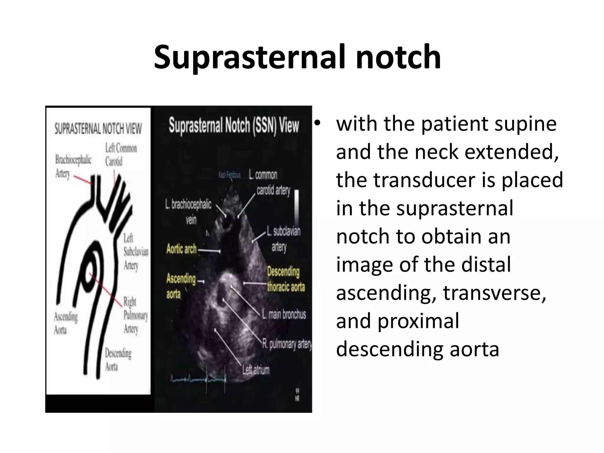2 d echocardiography views | PPTX
