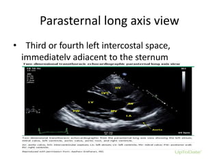 2 d echocardiography views | PPTX