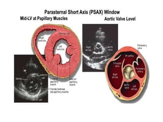 2 d echocardiography views | PPTX