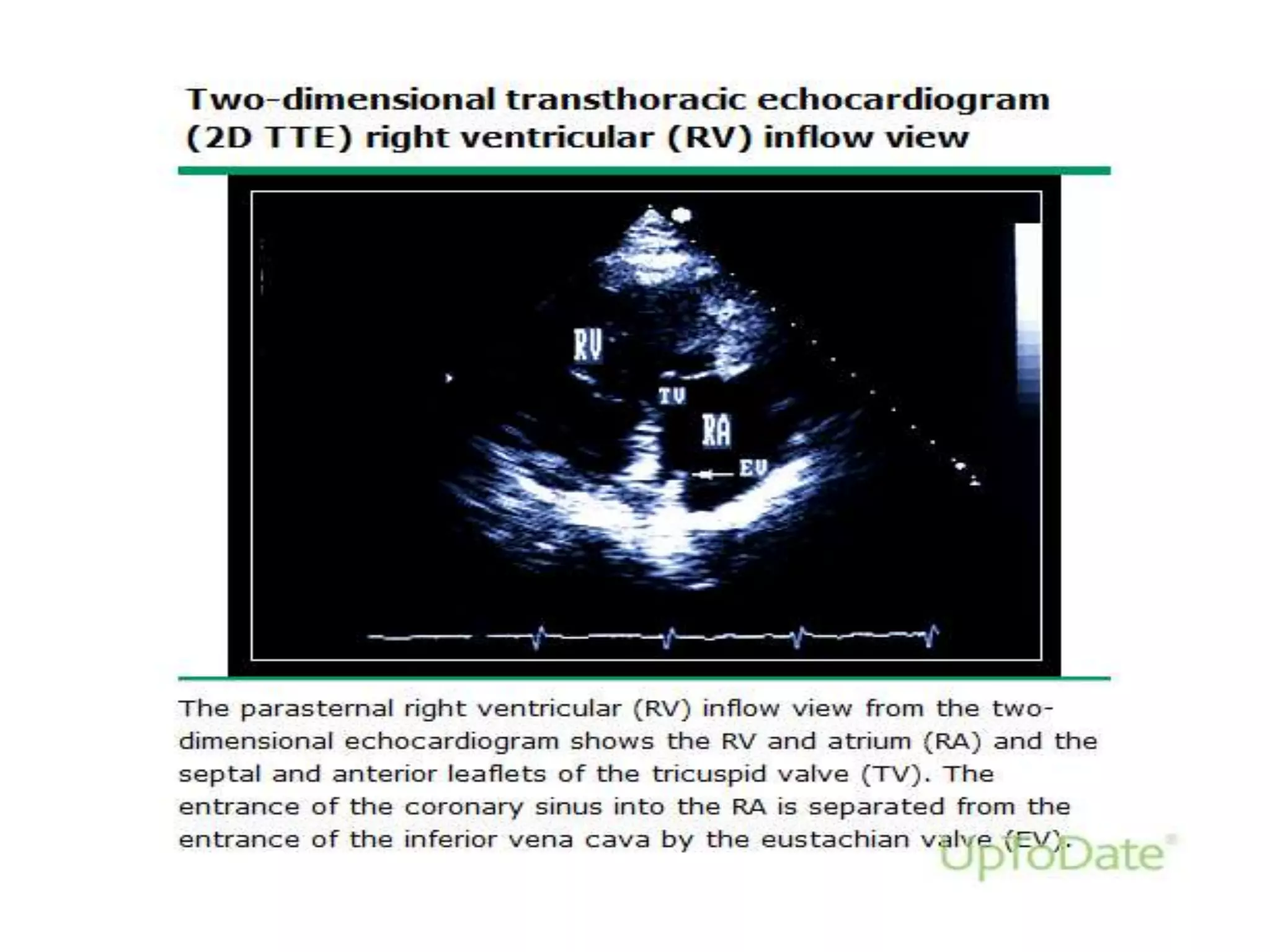 2 d echocardiography views | PPTX | Digital Audio | Computer Software ...