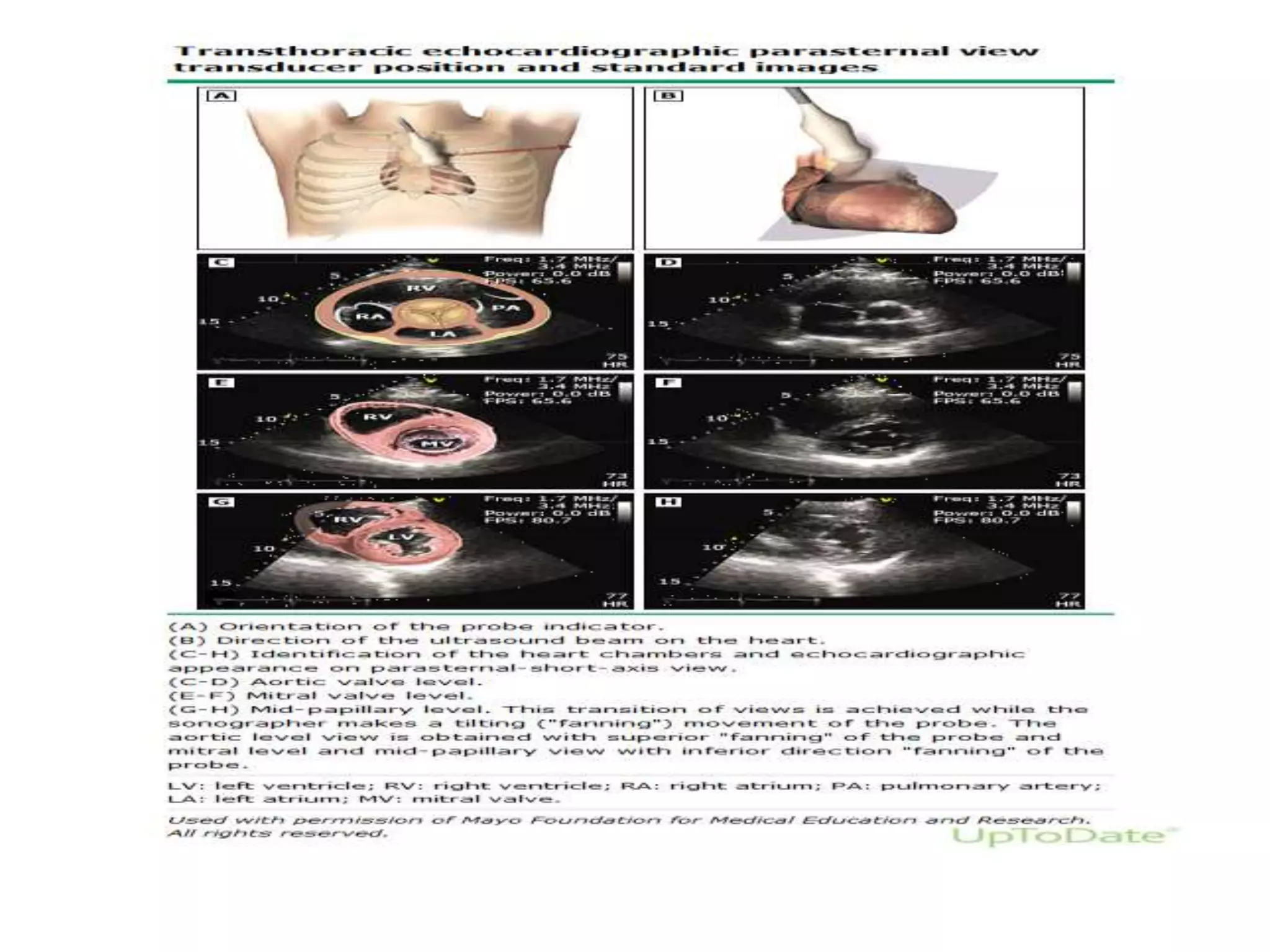 2 d echocardiography views | PPT