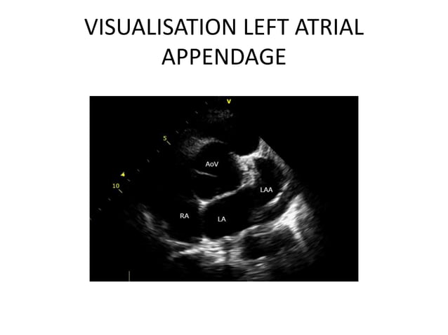 2 d echocardiography views | PPTX | Digital Audio | Computer Software and Applications