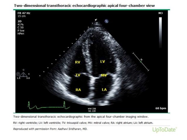 2 d echocardiography views | PPTX | Digital Audio | Computer Software and Applications