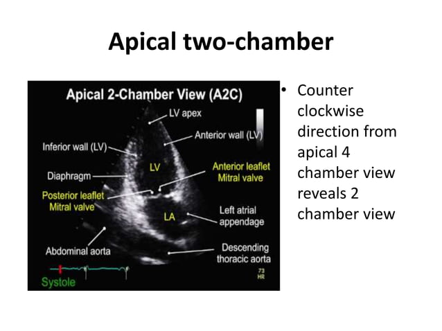 2 d echocardiography views | PPTX | Digital Audio | Computer Software and Applications
