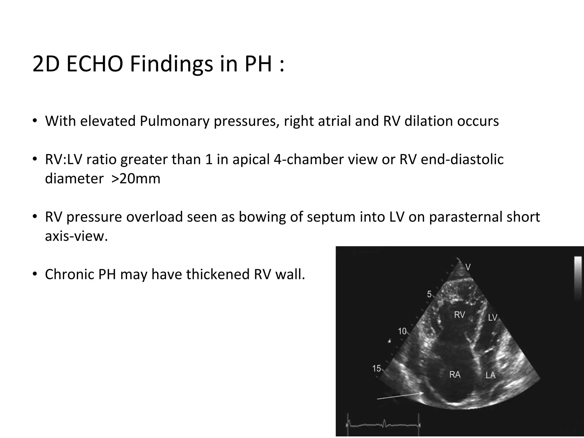 2D ECHO in pulmonology | PPTX