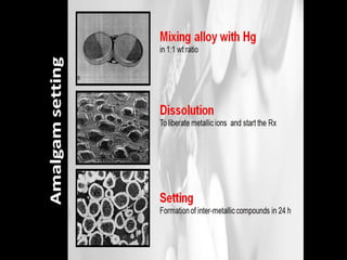 dental amalgam dental material | PPT