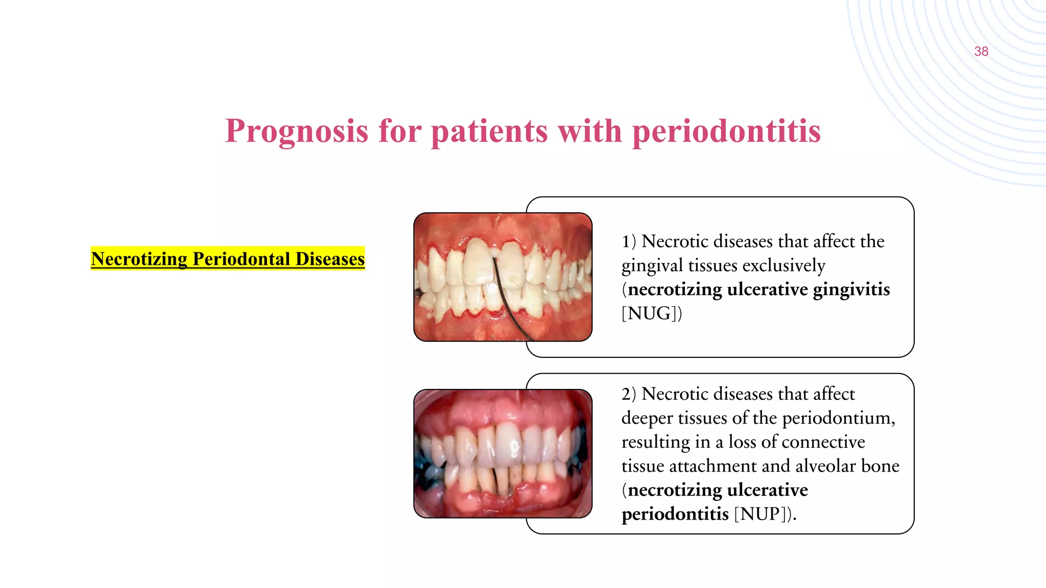 Determination of prognosis & Treatment plan | PDF