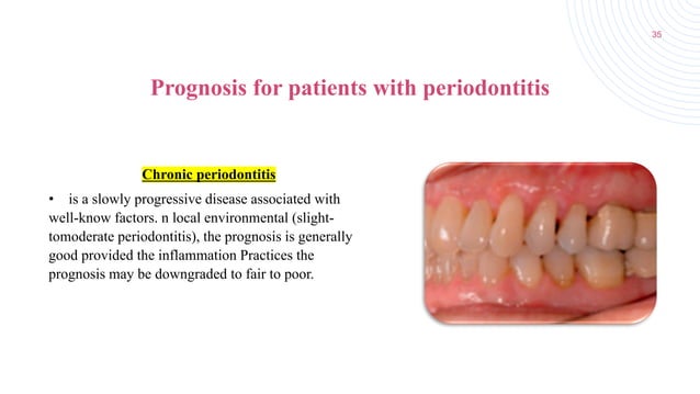 Determination of prognosis & Treatment plan | PDF