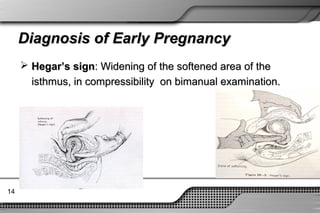 2 diagnosis of pregnancy | PPT