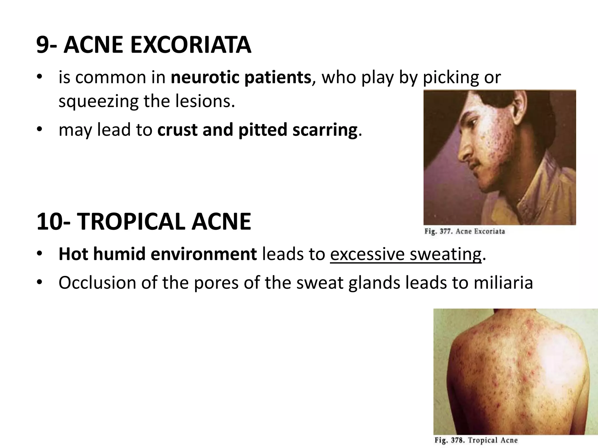 dermatology. disorders of sebaceous and sweat glands.(dr.faraydwn) | PPTX