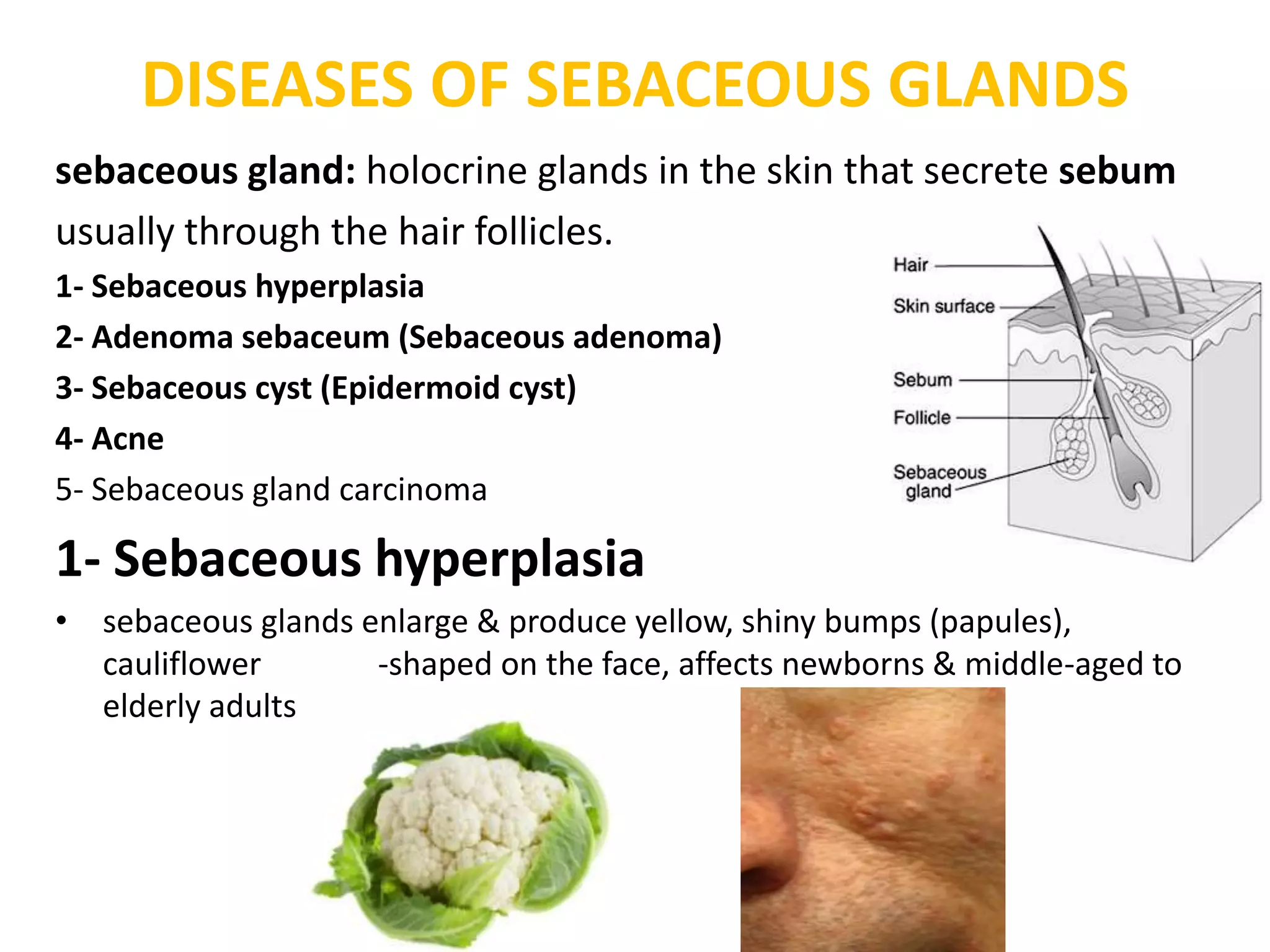 dermatology. disorders of sebaceous and sweat glands.(dr.faraydwn) | PPTX