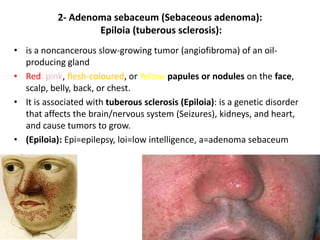 dermatology. disorders of sebaceous and sweat glands.(dr.faraydwn) | PPTX