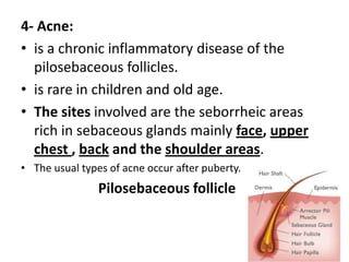 dermatology. disorders of sebaceous and sweat glands.(dr.faraydwn) | PPTX