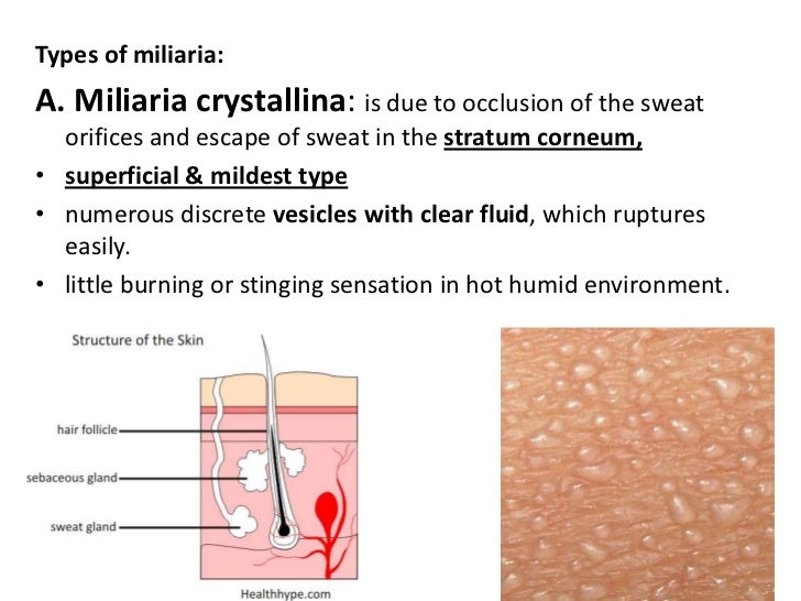 dermatology. disorders of sebaceous and sweat glands.(dr.faraydwn)