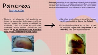exploración de Abdomen-introducción a la salud | PDF