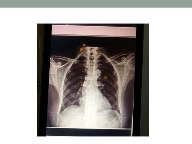 Radiografía de torax.pptx