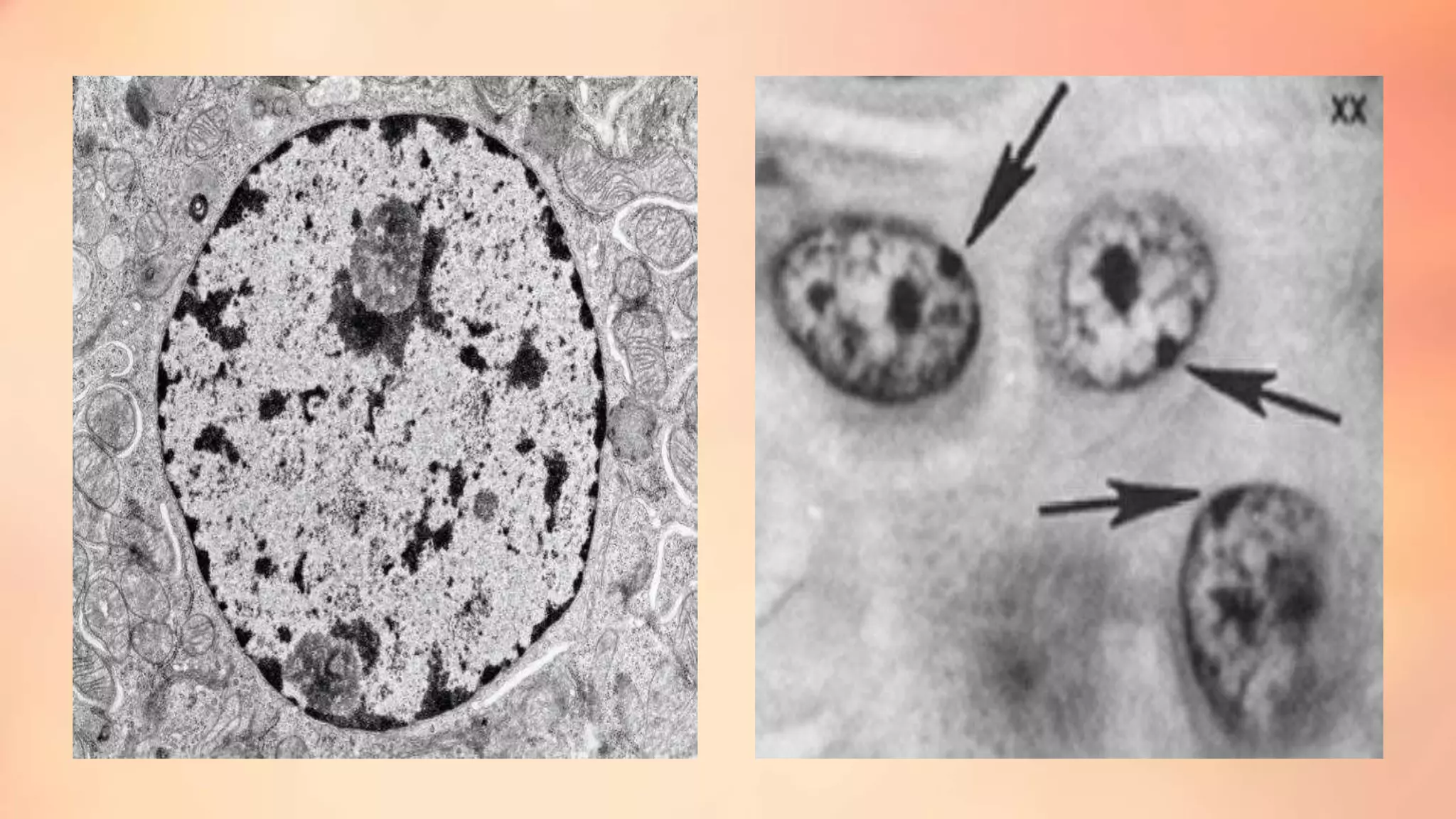 Heterochromatin and euchromatin mains | PPTX