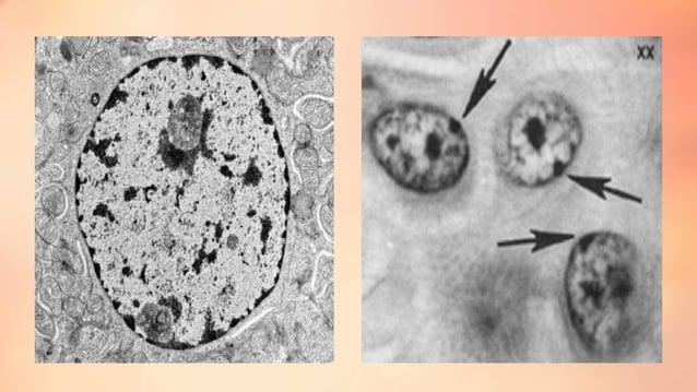 Heterochromatin and euchromatin mains | PPTX | Genetics | Science