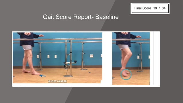 2D video Gait Analysis | PPTX | Foot Health | Diseases and Conditions